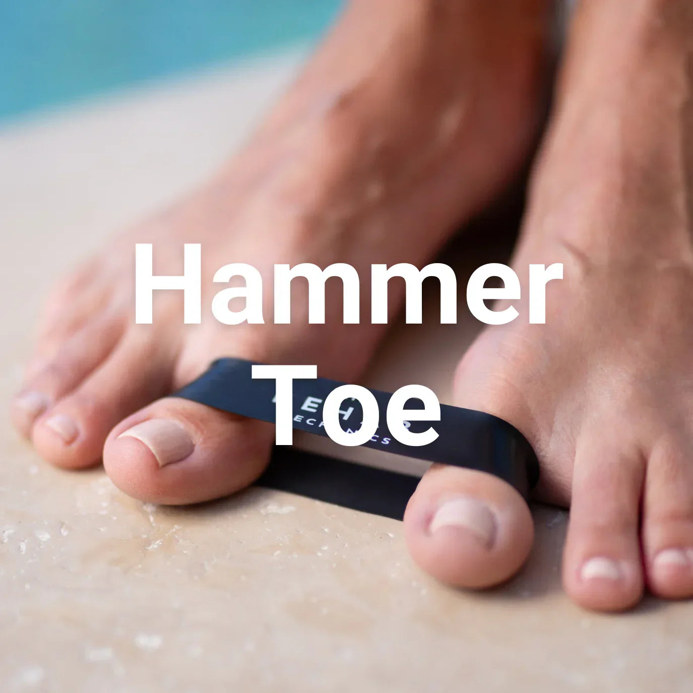 Hammer Toe – The Rehab Mechanics US